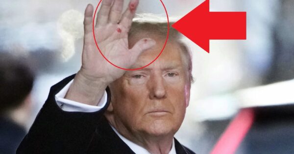Donald Trump's strange red hands go viral - The Horn News